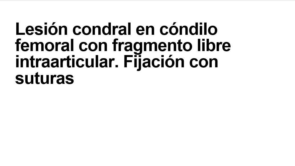 EP128 Lesión condral en cóndilo femoral con fragmento libre ...